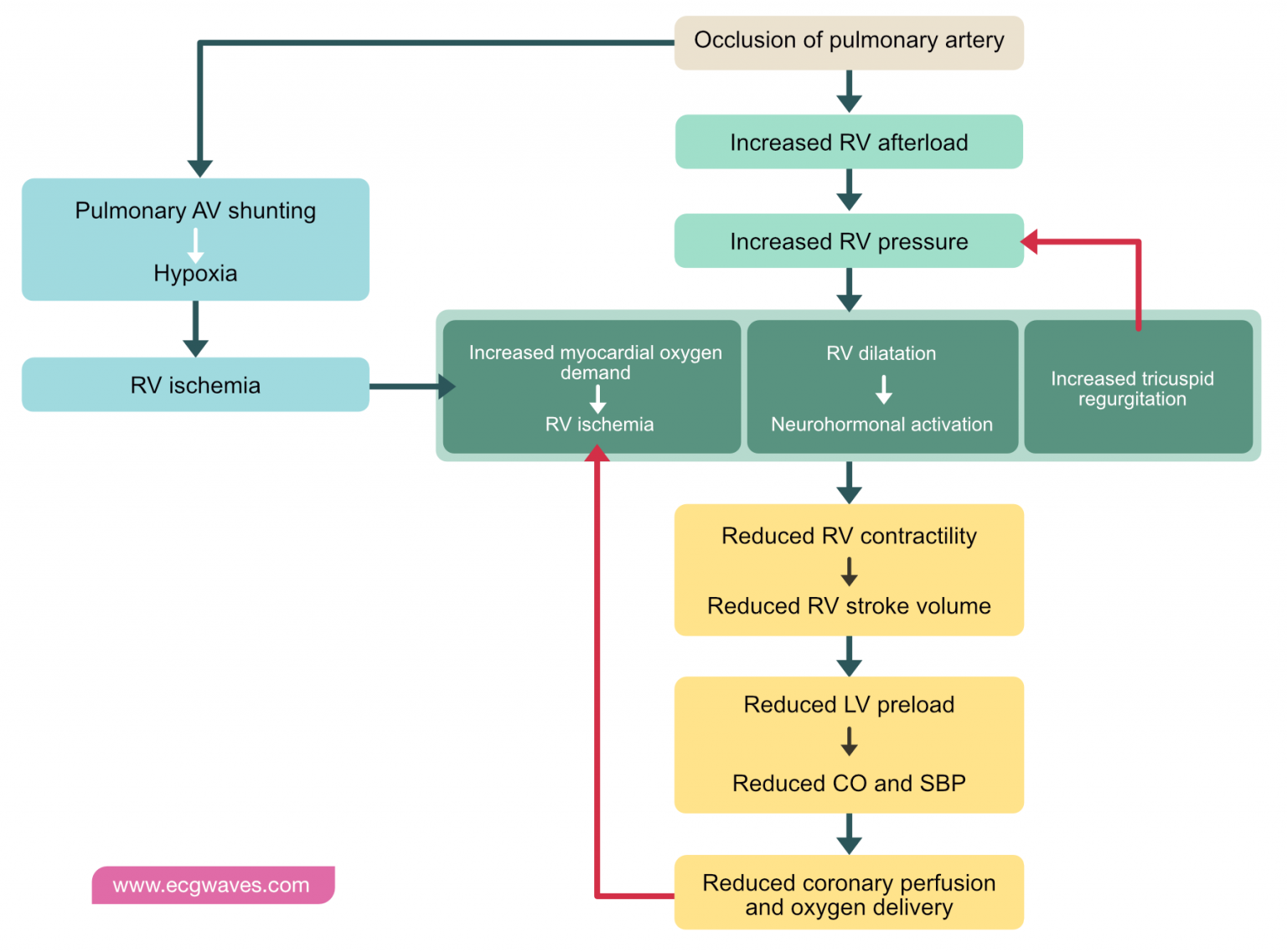 Lungeemboli (PE): Årsaker, symptomer, diagnose, behandling